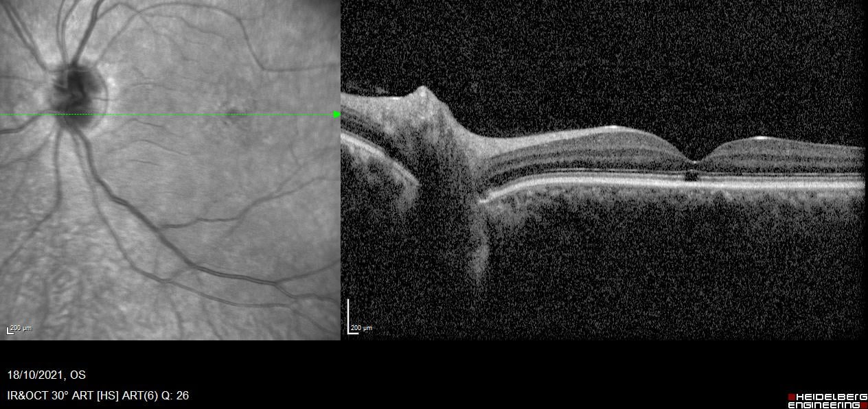 Κληρονομούμενα Νοσήματα & Διάγνωση – EL-VIS